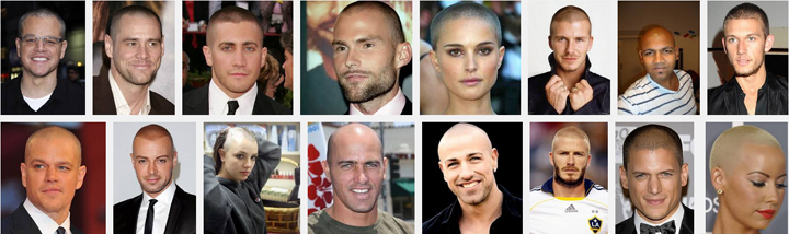 The real reason the men in your life are bald… - Starts at 60
