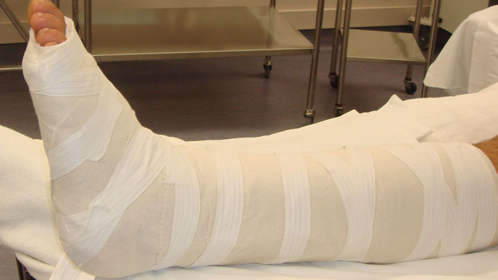 When breaking a leg breaks the drought… - Starts at 60