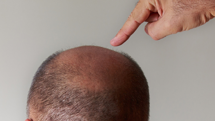 Exposing a sore spot - Starts at 60