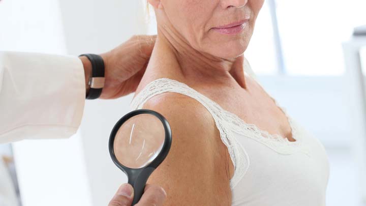 Do I need a skin cancer check? - Starts at 60