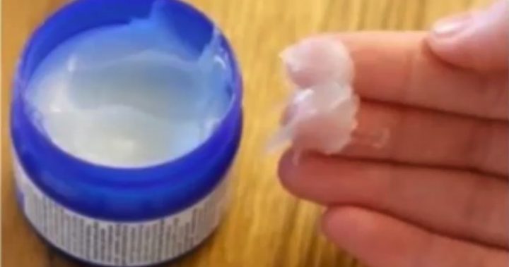 8 more extraordinary uses for chest rubs - Starts at 60