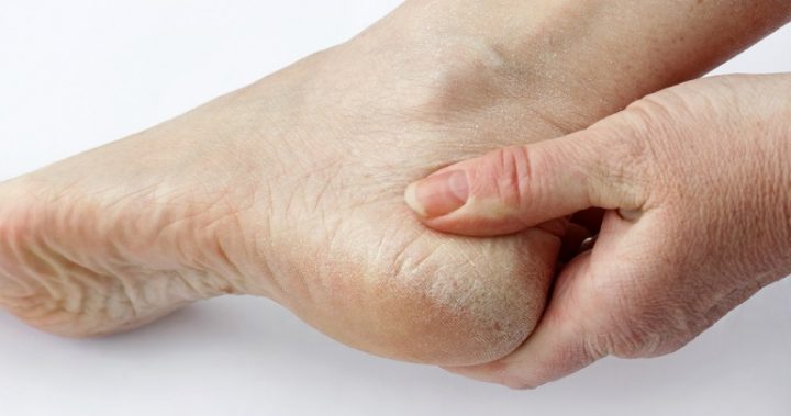 Common problems for older skin and how to fix them - Starts at 60