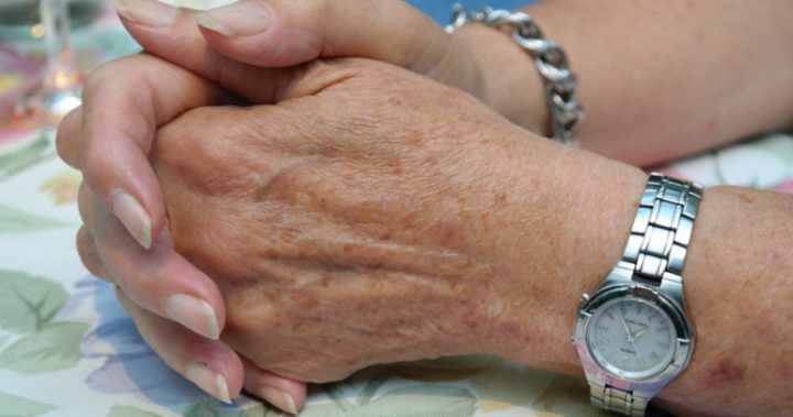 Home remedies for preventing and treating your paper thin skin - Starts ...