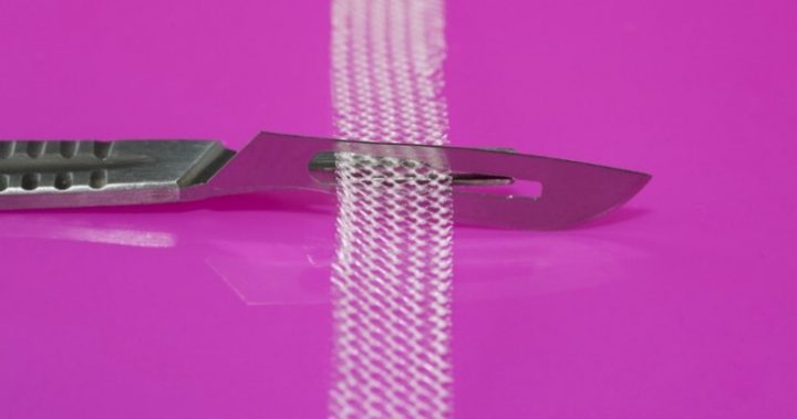 Pelvic mesh devices to be banned in Australia - Starts at 60