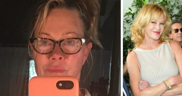 Melanie Griffith’s powerful warning as she reveals update on skin ...
