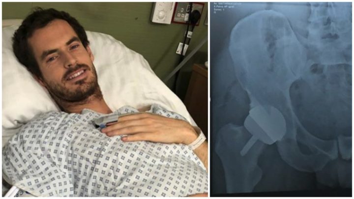 ‘I have a metal hip!’ Andy Murray reveals he’s undergone major surgery ...