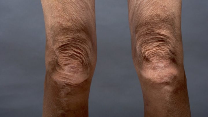 ‘Bandy legs: A bit of a chuckle and a reminder to be kind to yourself ...