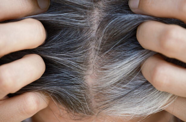 Scientists discover root cause of grey hair and potential way to ...